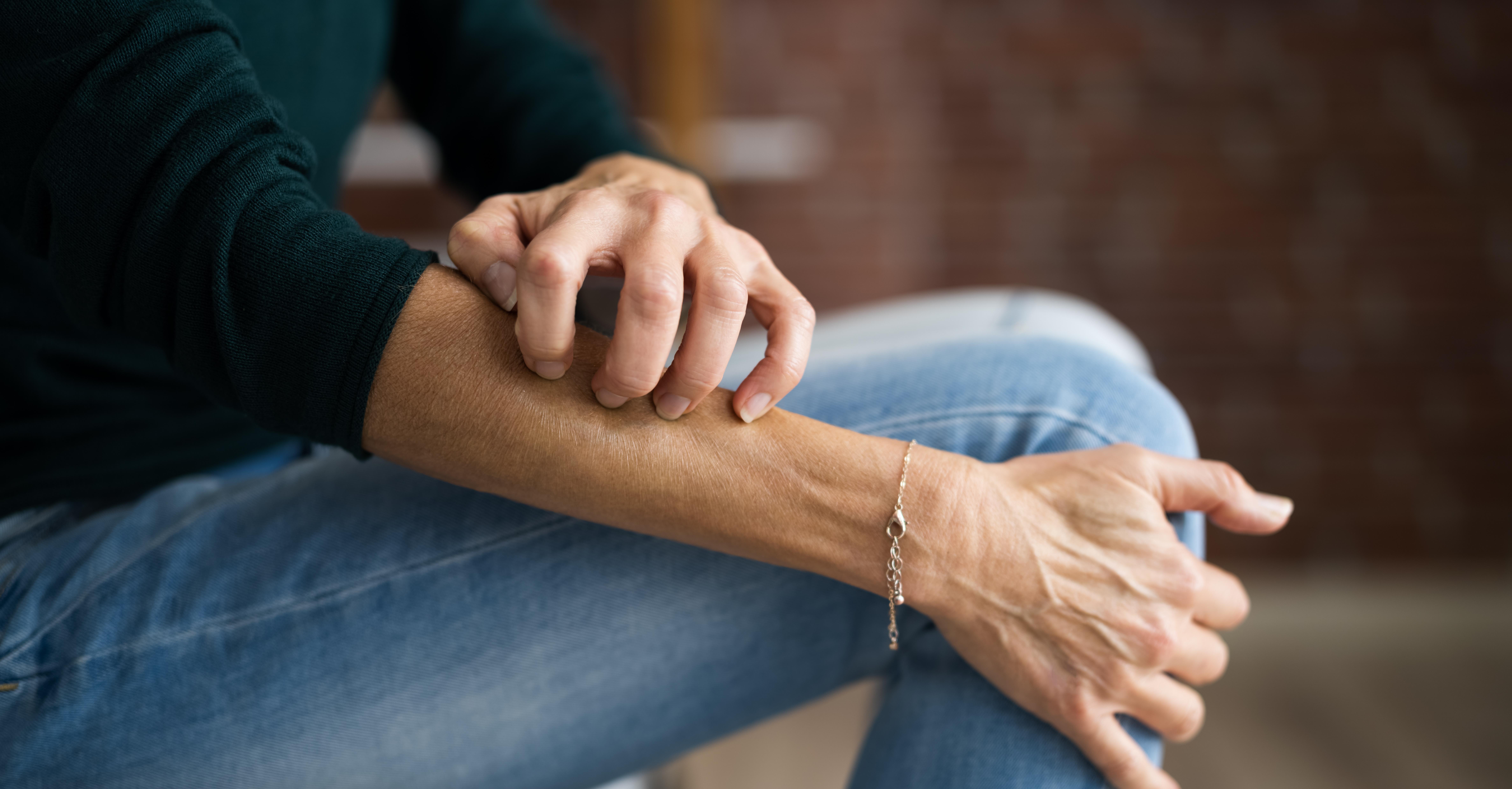 What You Should Know About Living with Guttate Psoriasis - Dario Connect